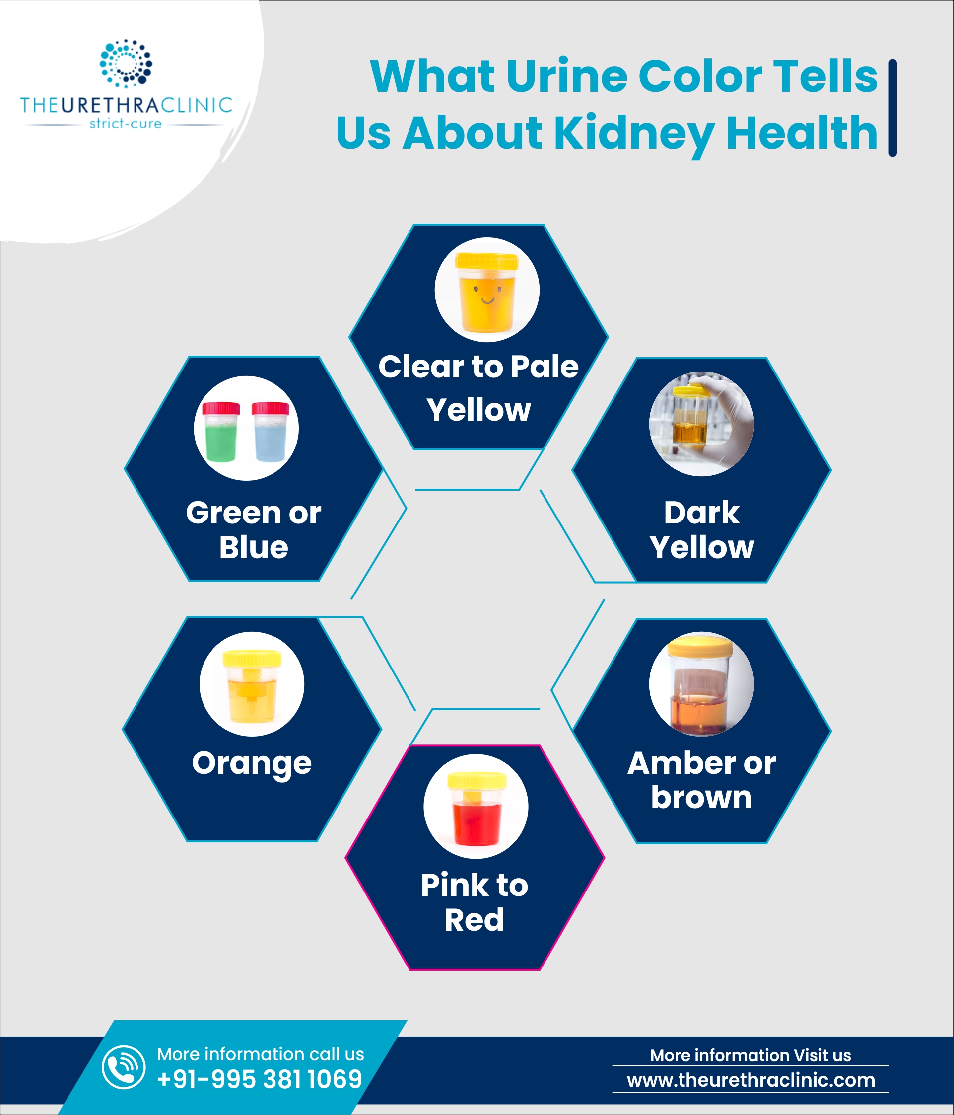 Kidney Failure Treatment – Best Care Options for Recovery